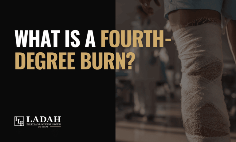 What is a Fourth-Degree Burn? | Ladah Injury & Car Accident Lawyers Las ...
